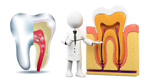 How To Reduce Root Canal Treatment Cost Dentist Canberra