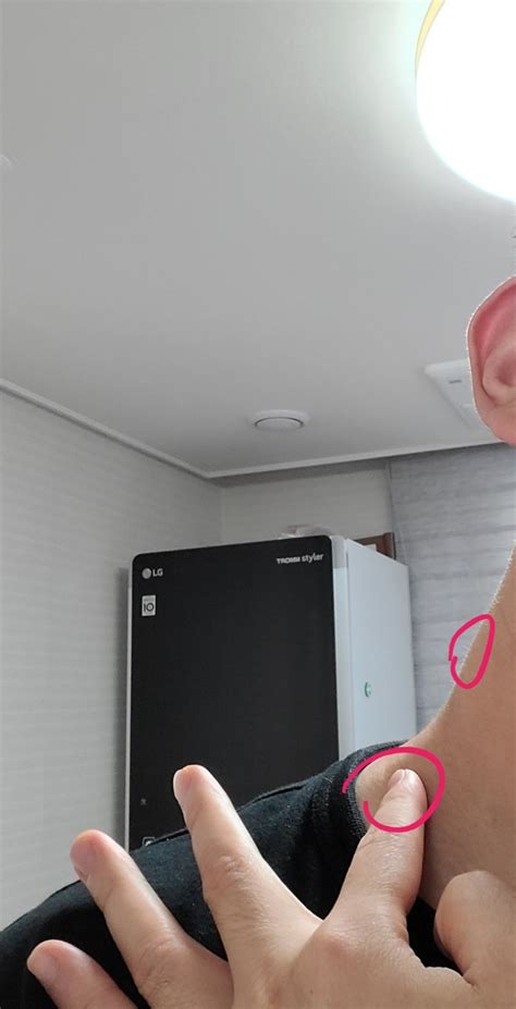 빨간동그라미 쪽이 붓고 만지면 아파요 지식in