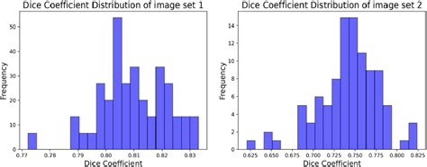 Figure 2 From An Unsupervised Approach Towards Promptable Defect Segmentation In Laser Based