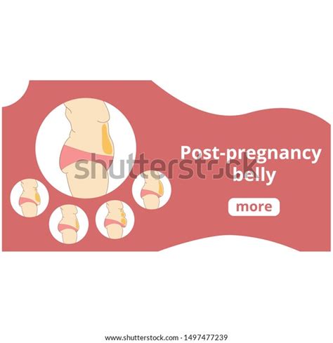 Types Female Tummies Banner Tummy Tuck Stock Vector Royalty Free