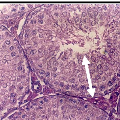 Photomicrograph Of Testicular Tissues In Control Rat The Average Wall