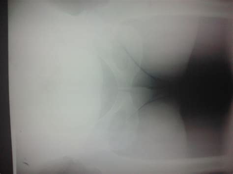 Ghost Vagina Album On Imgur