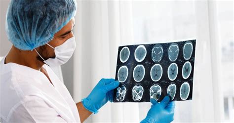 Šta Je To Aneurizma Krvnog Suda