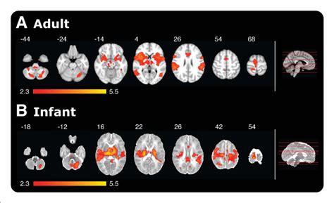 Noxious Evoked Brain Activity In Response To The Maximal Presented