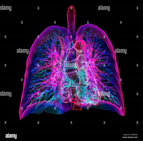 Human Heart And Lungs Coloured 3d Computed Tomography Ct Scan Of