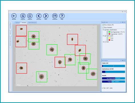 Sca Casa System Microptic