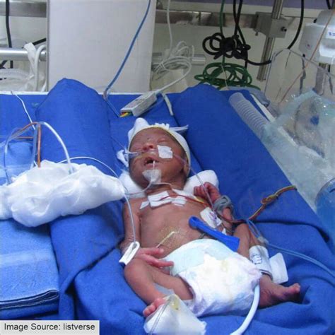 Understanding Premature Birth Causes And Risk Factors