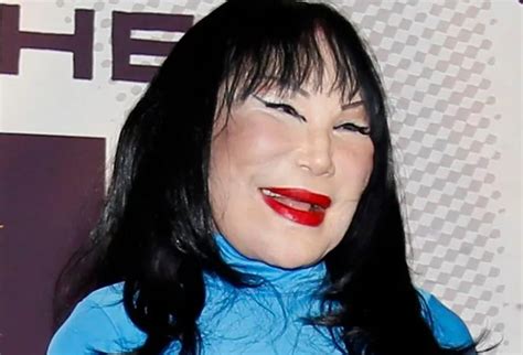 What Happened To Lyn May Face Has Lyn May Had Plastic Surgery