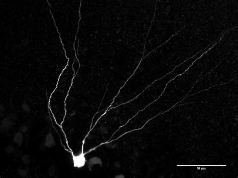 A Dentate Granule Cell From The Dentate Gyrus In The Hippocampus R Neuroscience