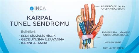Karpal T Nel Sendromu Inca Klinik