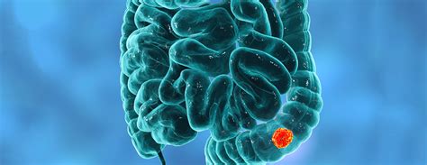 Endoscopic Microsurgery Definition At Jessica Goza Blog