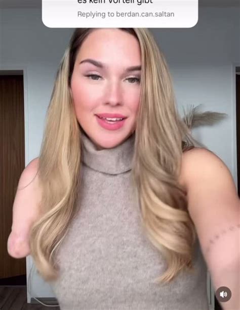 Video Tagged With Amputee Amputeegirl Distantlimbs On Tumblr