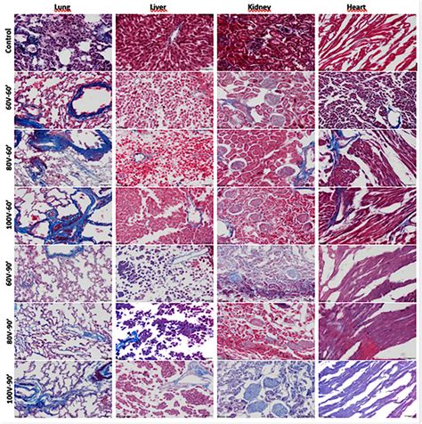 Masson Trichrome Staining Of Transverse Histological Cross Sectioned