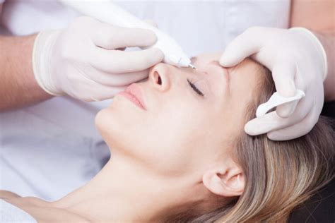Facial Warts How To Identify And Treat This Common Nuisance