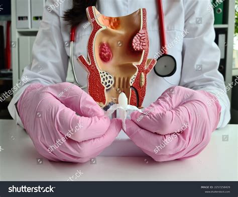 35 Imágenes Fotos De Stock Objetos En 3d Y Vectores Sobre Rectal