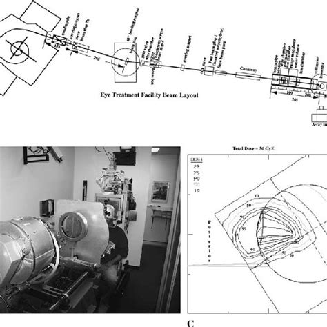 A Linac Radiosurgery Unit With Multileaf Collimator Novalis B