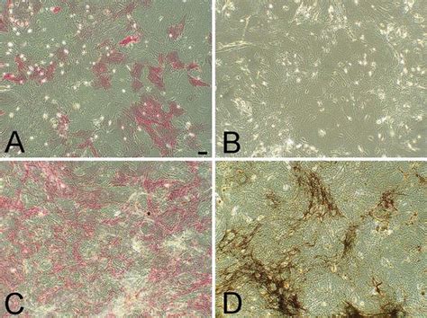 Figure 2 Figure 2 From Micrornas Regulate Osteogenesis And Flickr