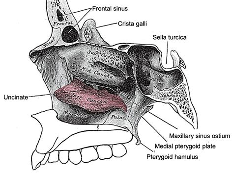 1 31 Total Maxillectomy And Orbital Exenteration Medicine Libretexts
