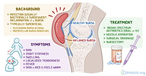 Septic Bursitis What Is It Causes Treatment And More Osmosis
