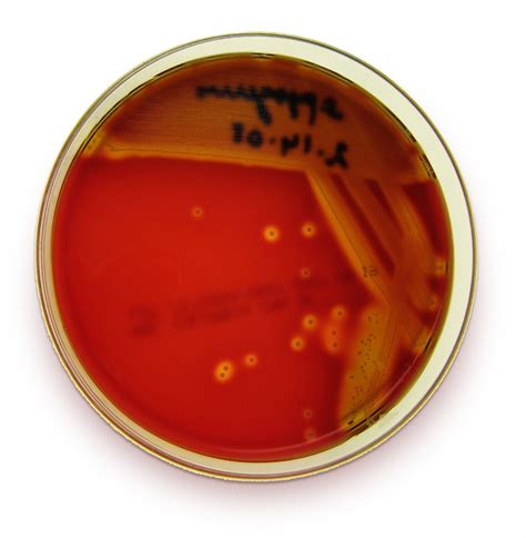 Cultivation Media For Bacteria