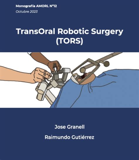 Transoral Robotic Surgery Tors Head And Neck Robotic Surgery