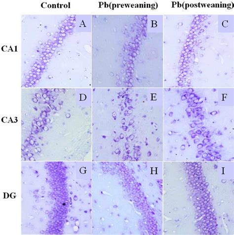 The Pre Weaning But Not Post Weaning Pb Exposure Reduces The Number Of