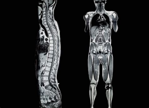 Badanie onkologiczne WHOLE BODY rezonans całego ciała MR Diagnostic