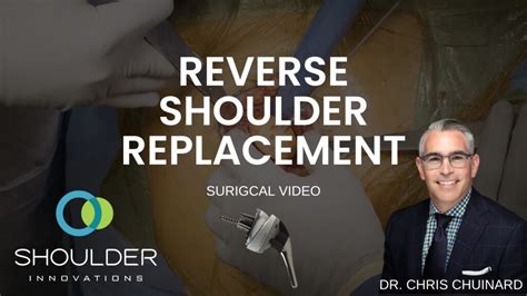 Dr Chris Chuinard Reverse Shoulder Replacement Surgery Video