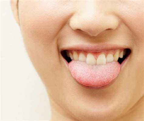 Is A Lisp A Speech Impediment