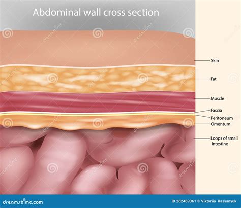 Abdominal Wall Cross Section Anatomy Abdominal Wall Layers Cartoon