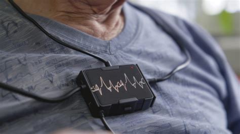 Ensuring Diagnostic Precision Emi Shielding For Medical Devices