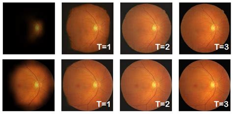 Nui Go Recursive Non Local Encoder Decoder Network For Retinal Image