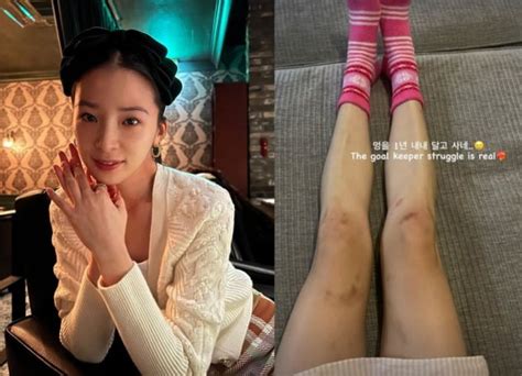 아이린 온 다리에 멍이부럴질 것 같은 각선미 충격 Ten★ 텐아시아