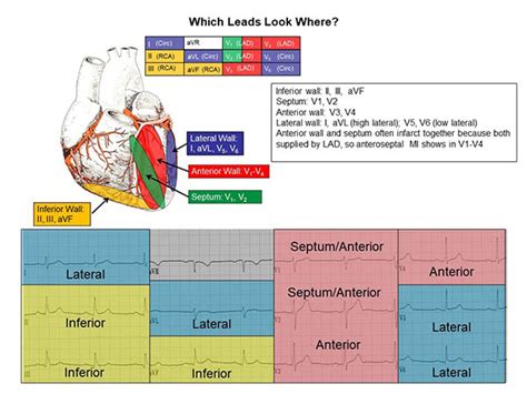 Printable 12 Lead Ekg Interpretation Cheat Sheet Printable Templates