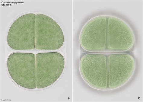 Chroococcus Giganteus Real Micro Life