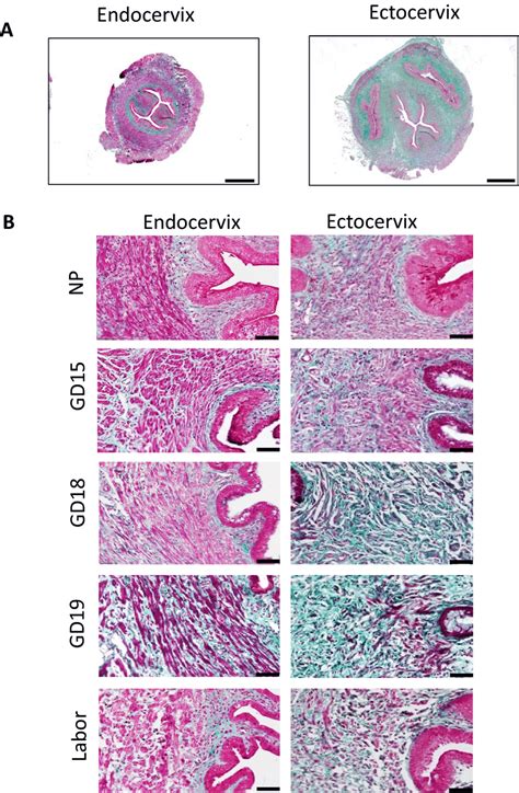 Endocervix Histology
