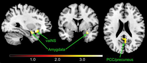 Different Brain Responses Associated To Sex Significantly Greater Download Scientific Diagram
