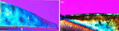 Polarised Microscope Photomicrographs Of Tooth Sections At The Crown Download Scientific