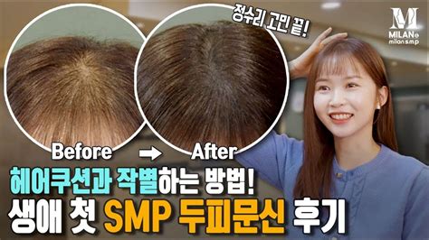 여성 헤어라인과 정수리 커버를 완벽하게 밀란 숱채움smp의 섬세함 상상만해도 행복한 숱채움smp 두피 문신으로 완쁨