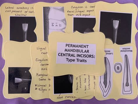 Dental Flashcards Incisor Tooth Morphology For Dental Hygiene Babes Etsy