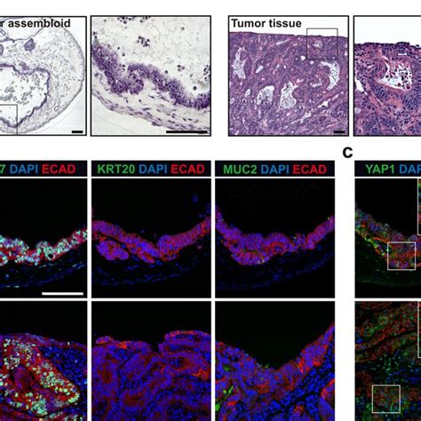 Establishment Of Colon Assembloids Modeling Colonic Crypt Formation A