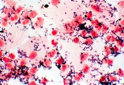 Vaginal Smear Light Micrograph Stock Image Science Source Images