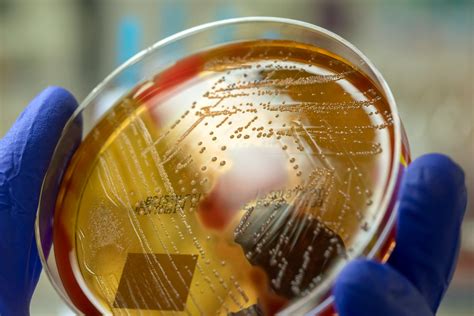 Uk Pledges £210m For Global Antimicrobial Resistance Surveillance