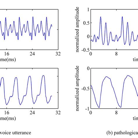 Illustration Of 3d Spectrograms Of Glottal Source Waveform Estimated Download Scientific