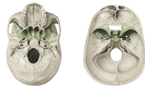 Sphenoid And Temporal Bone Flashcards Quizlet