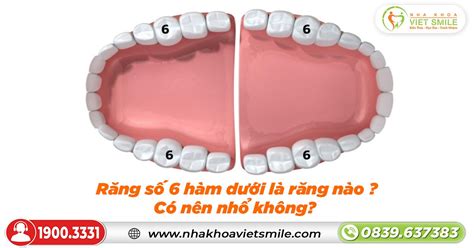 Răng Số 6 Hàm Dưới Là Răng Nào Có Nên Nhổ Không