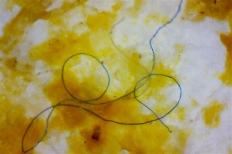 Comparison Of Microplastic Accumulation In Native And Invasive Sea Urchins Of The Aegean Sea