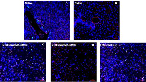 Decellularized Rat Liver Scaffolds Support Survival And Metabolic Function Of Multilineage