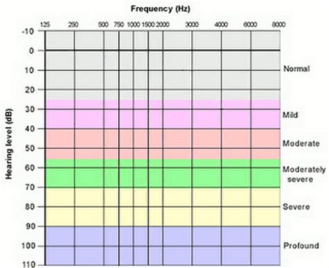 Db Hl Sensitivity To Sound Clinical Audiograms Auditory Neuroscience