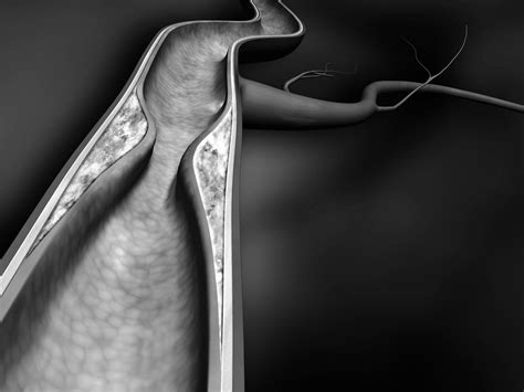 Spectrawave Inc Medical Imaging United States